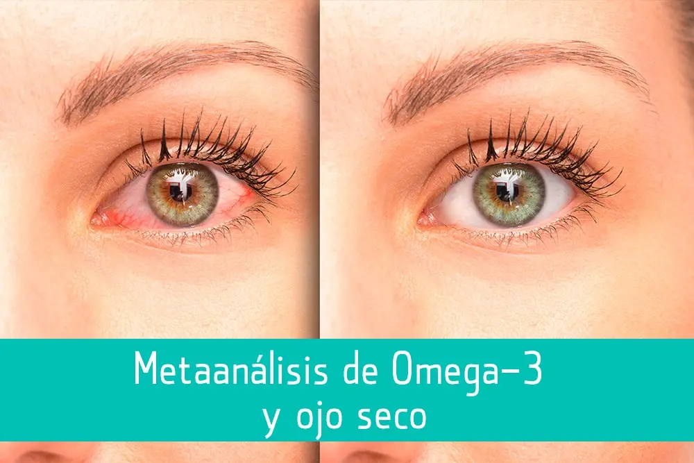 Metaanálisis de Omega 3 y ojo seco